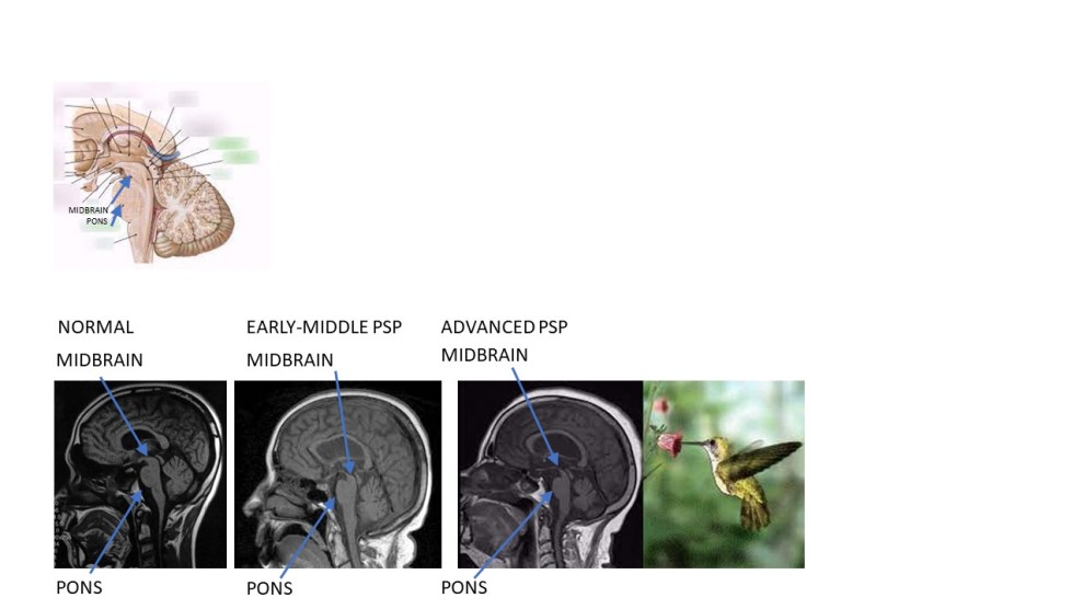 hummingbird sign | PSP Blog